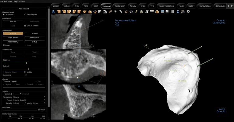 The Company - Osteoid Inc